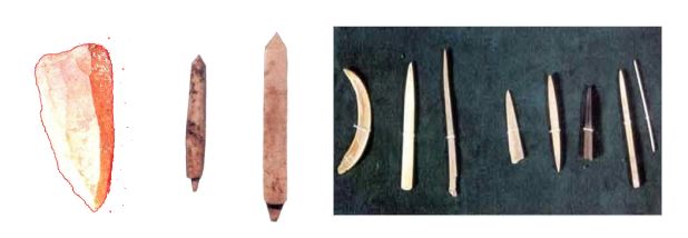 How Does Acupuncture Work? What Is Acupuncture?